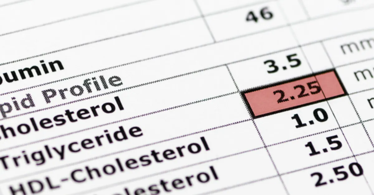 When is cholesterol considered high? - AL BORG DIAGNOSTICS