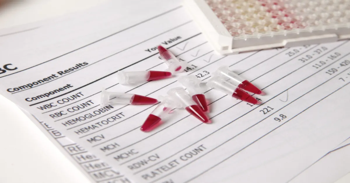 Complete Blood Count: What Does It Reveal? - AL BORG DIAGNOSTICS